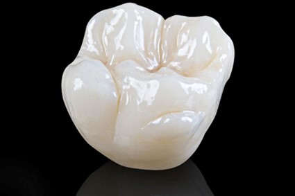 Coronas de Zirconio: Estética y funcionalidad para tus dientes ...